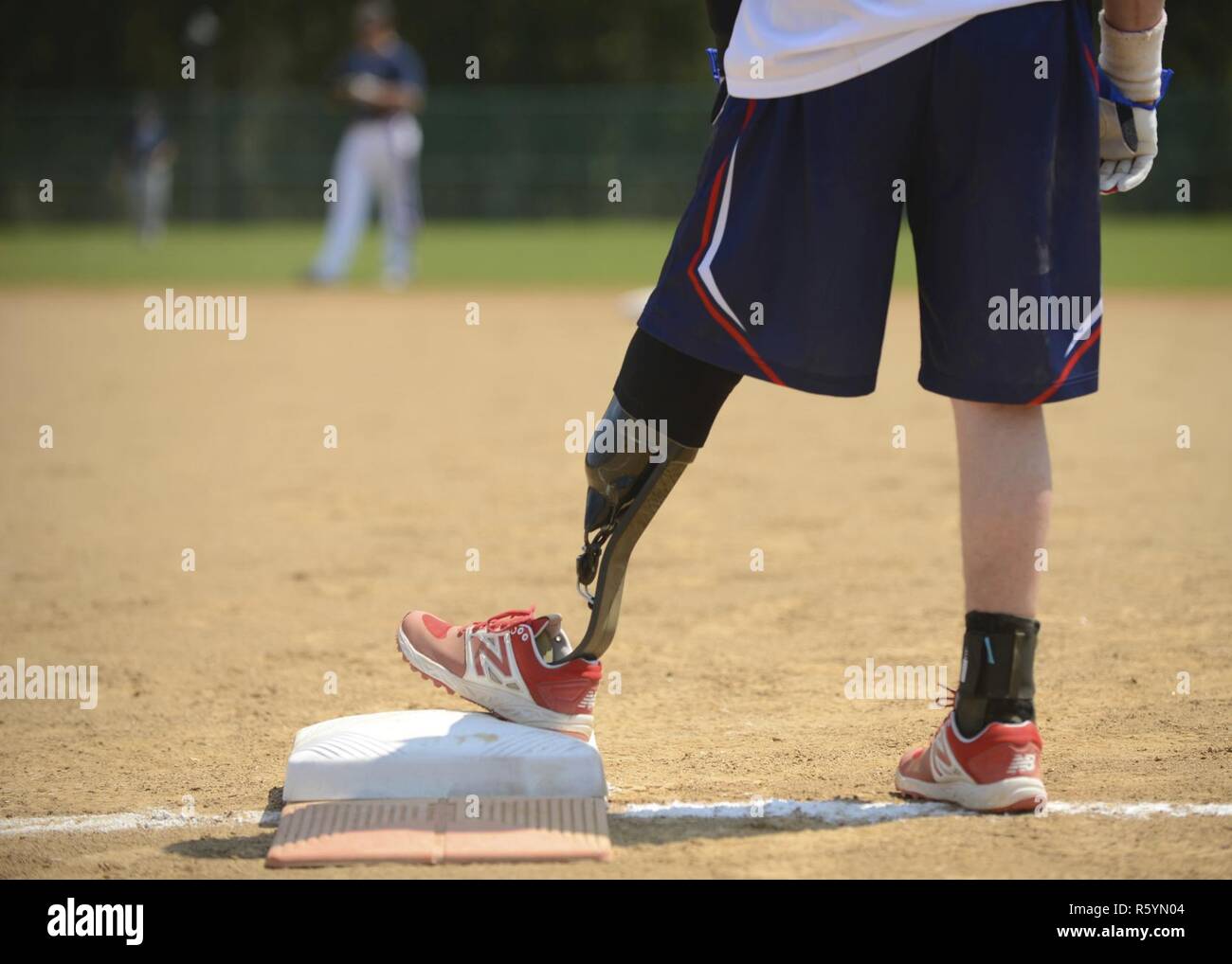 Above knee amputation hi-res stock photography and images - Alamy