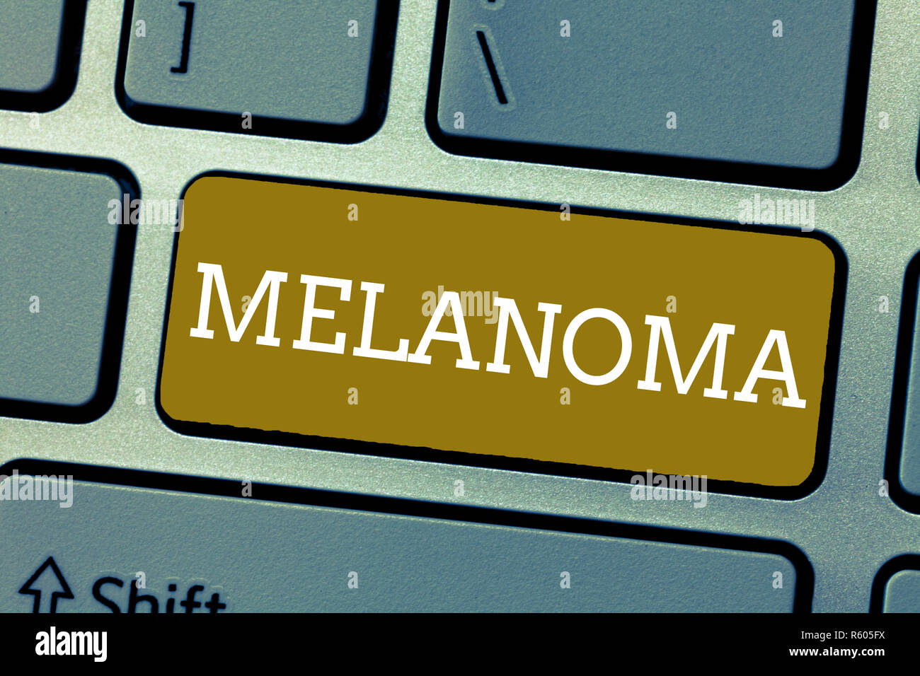 Handwriting text Melanoma. Concept meaning A malignant tumor associated with skin cancer Benign ...