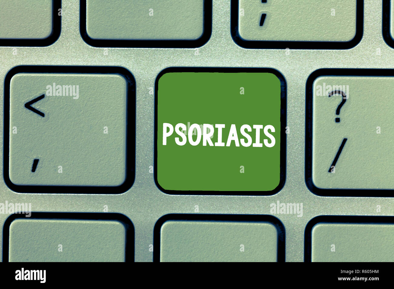 Text sign showing Psoriasis. Conceptual photo Common skin condition ...