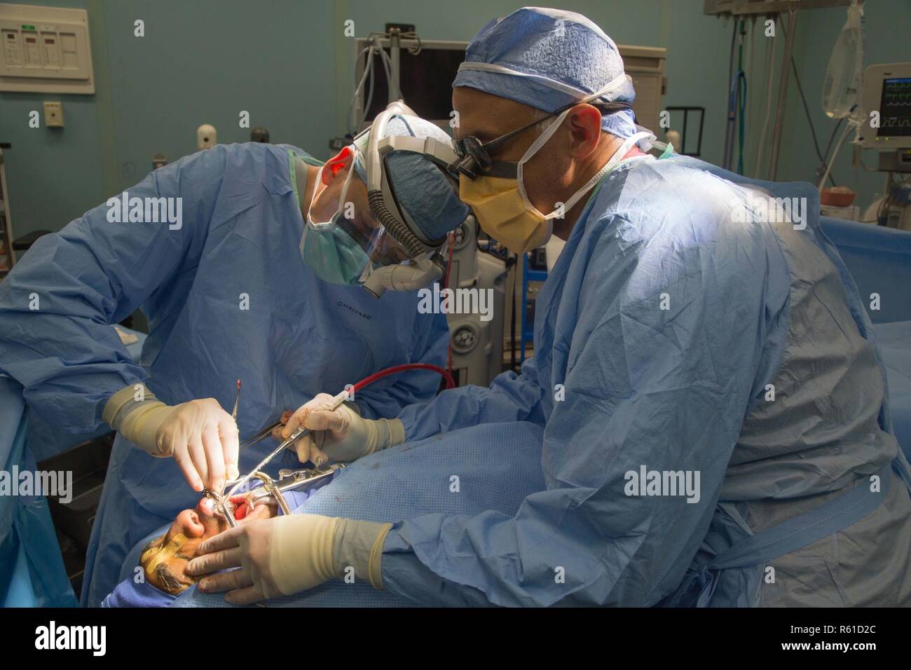 Cleft palate surgery hi-res stock photography and images - Alamy