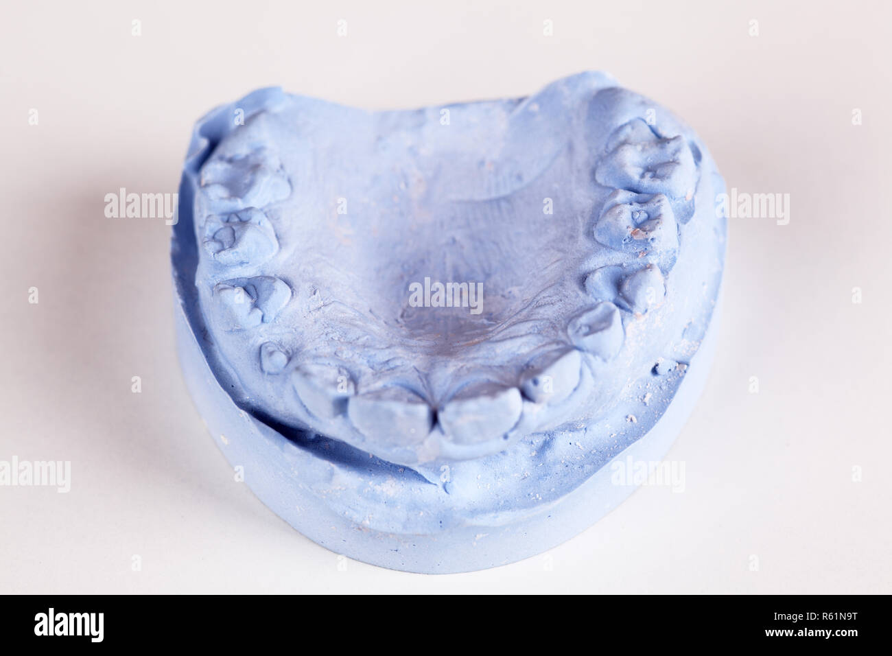 Dental Impression Stock Photos & Dental Impression Stock Images - Alamy
