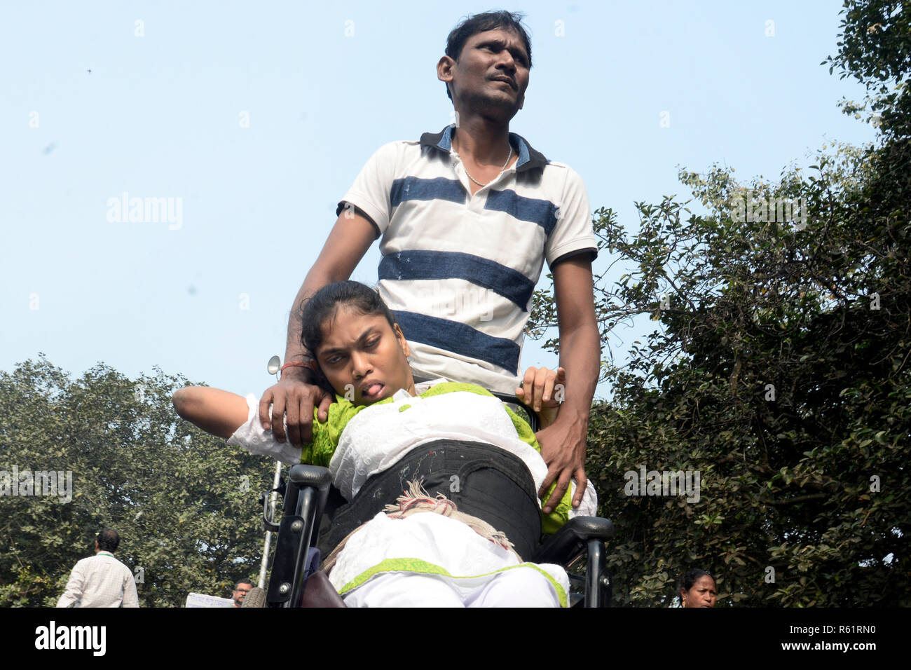 Kolkata, India. 03rd Dec, 2018. Indian man holds his disable girl in ...