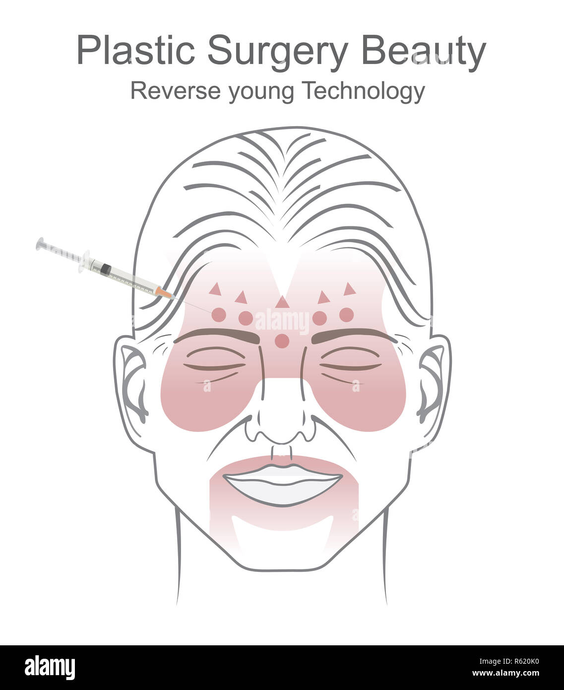 plastic surgery beauty Stock Photo - Alamy