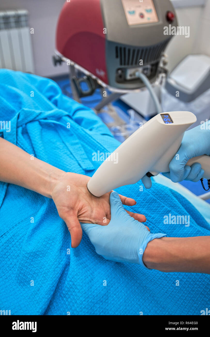 Procedure against hyperhidrosis Stock Photo - Alamy