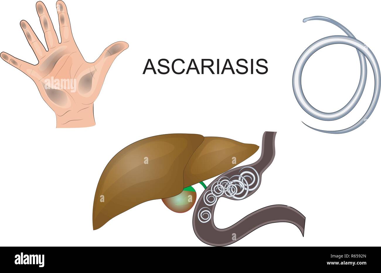 Infected hands Cut Out Stock Images & Pictures - Alamy