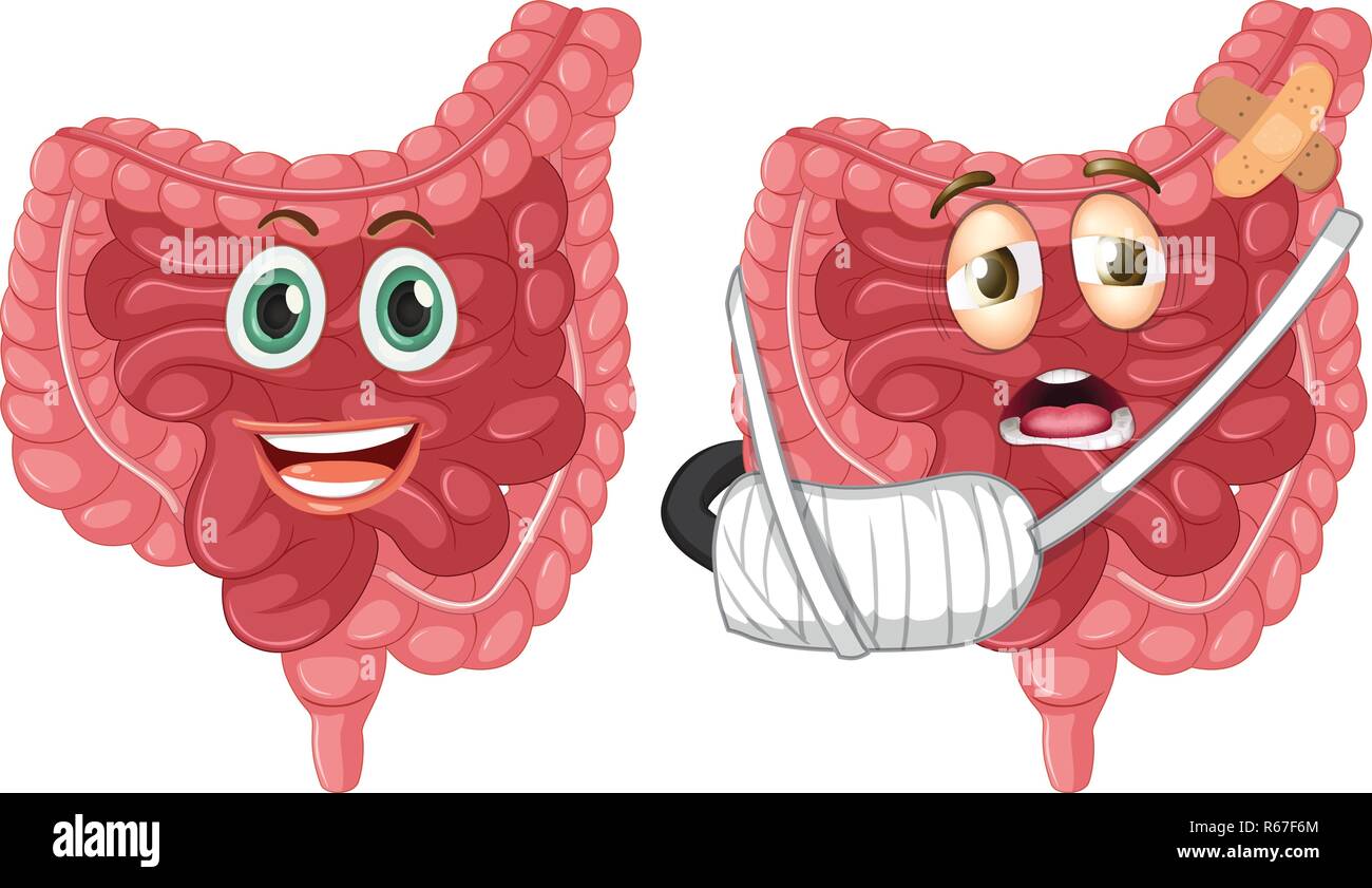 Set of healthy and injured intestine illustration Stock Vector Image ...