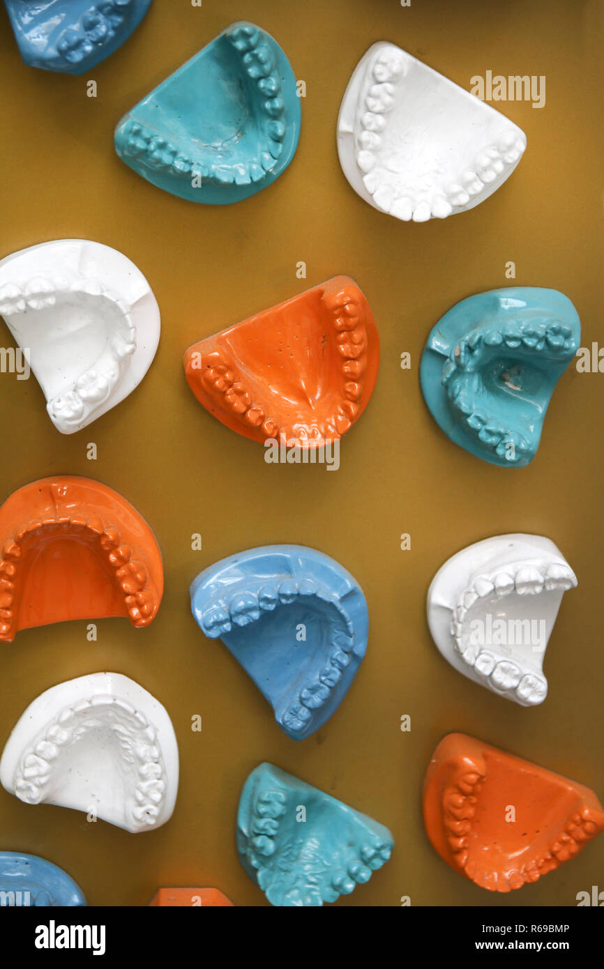 Paradentitis hi-res stock photography and images - Alamy