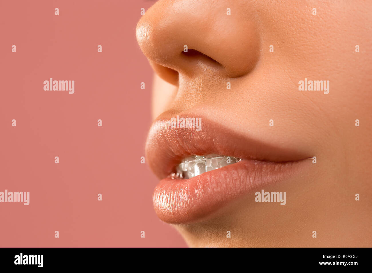 Beautiful young woman with teeth braces on pink Stock Photo - Alamy