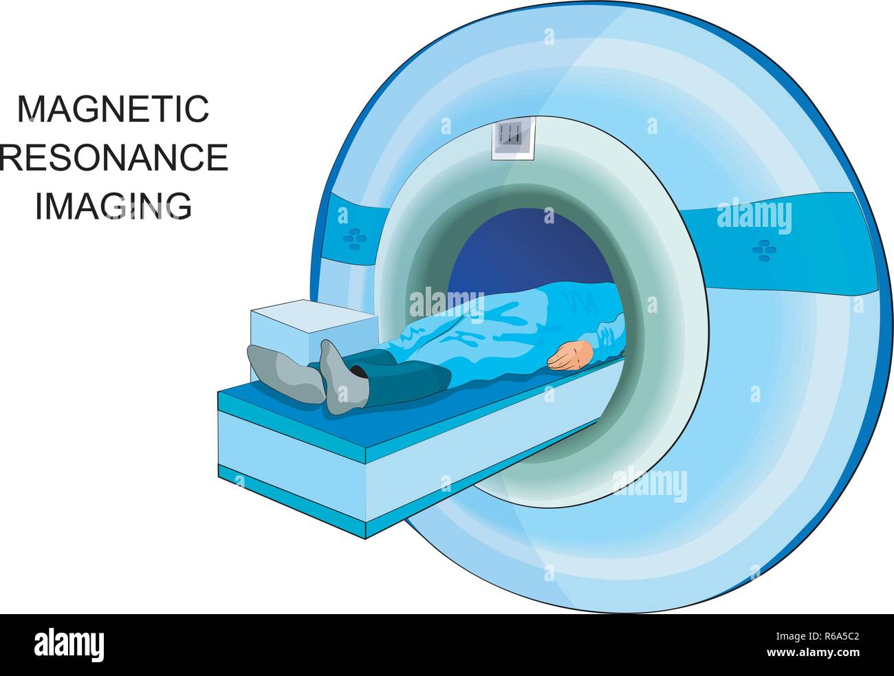 Mri cerebral infarction hi-res stock photography and images - Alamy