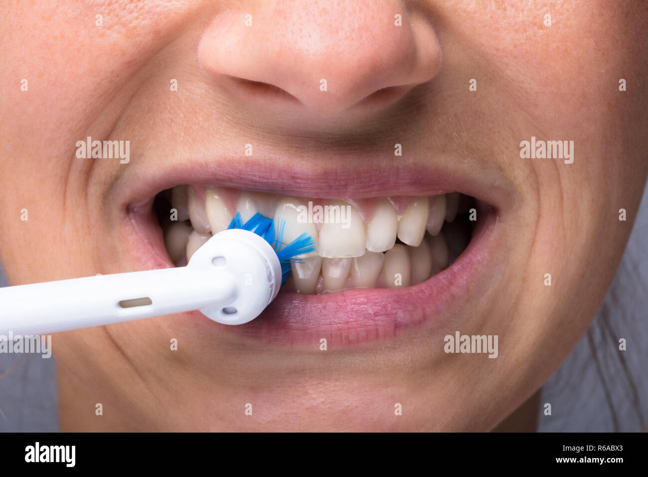 Woman's Teeth With Electrical Toothbrush Stock Photo - Alamy