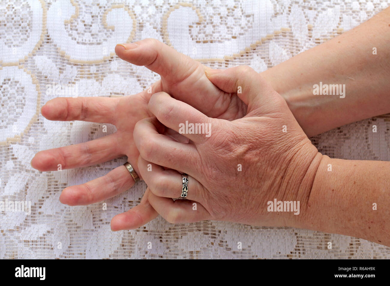 Woman tremble hands hi-res stock photography and images - Alamy