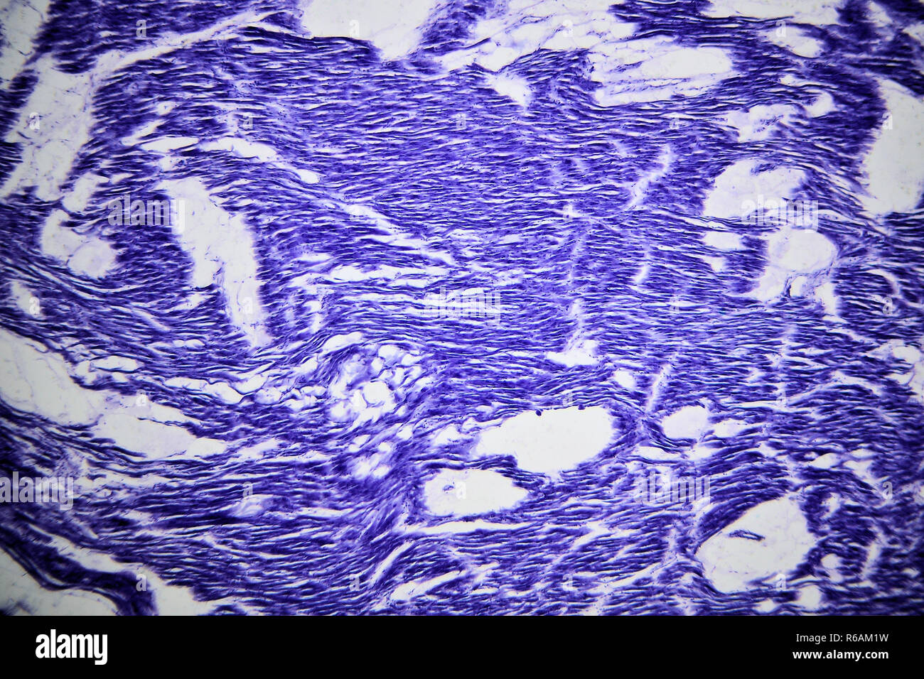Human Heart Muscle Under Microscope Stock Photo - Alamy
