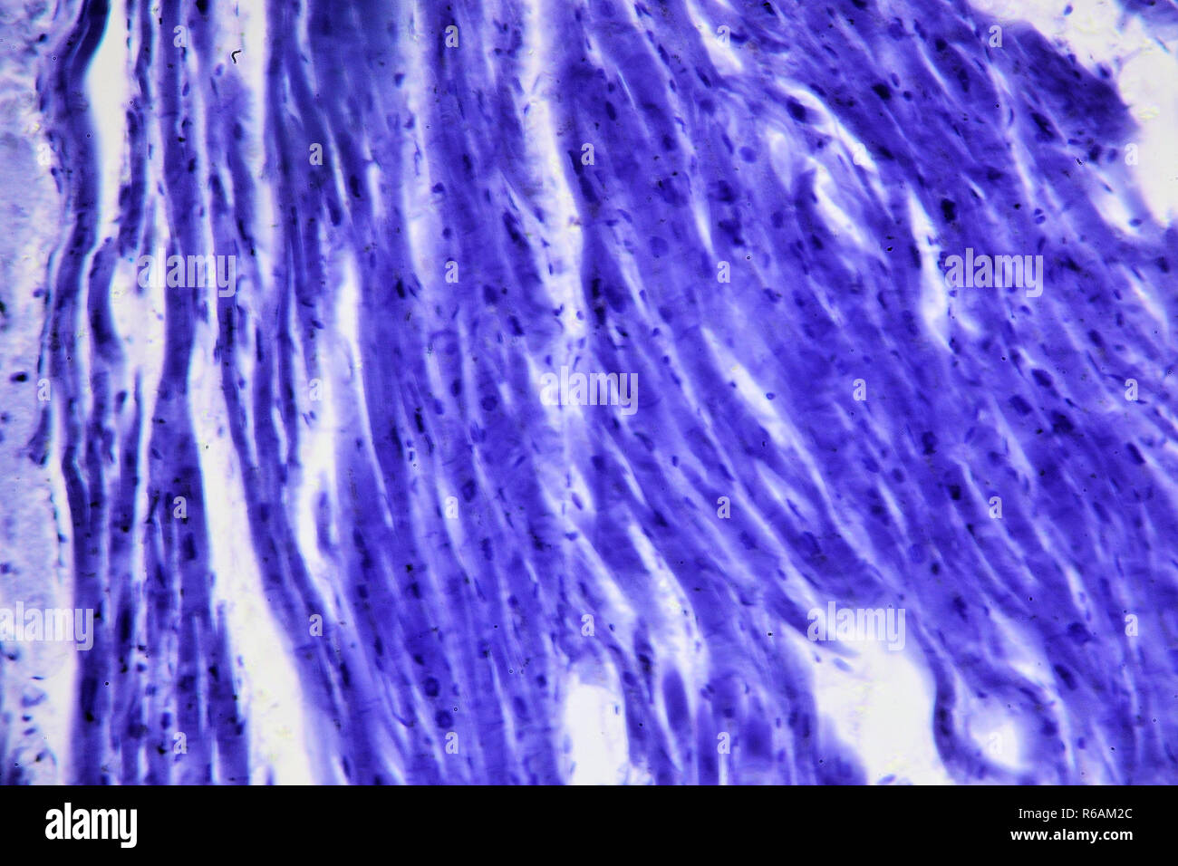 Human Heart Muscle Under Microscope Stock Photo - Alamy