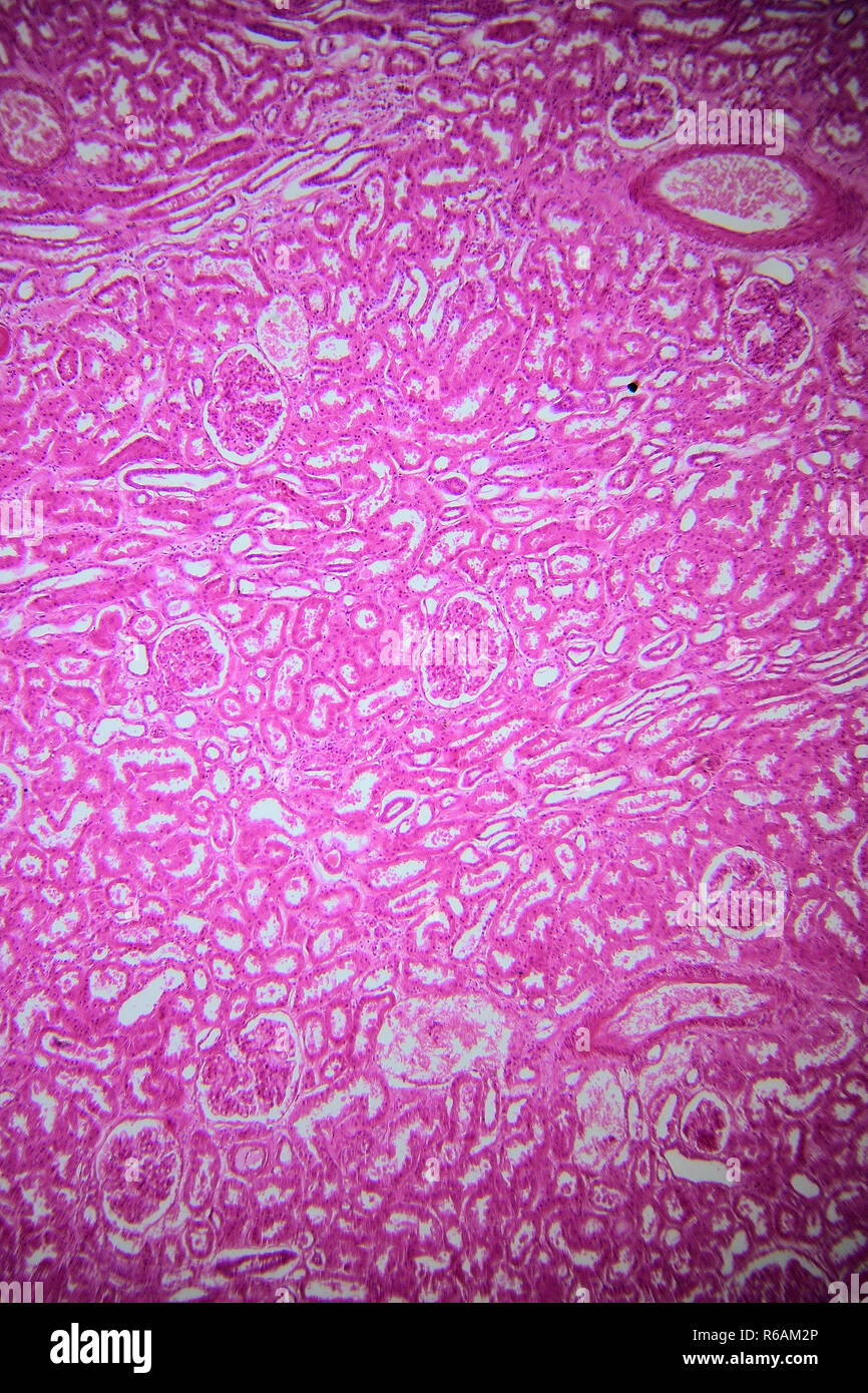 Human Kidney, Cortical Zone Under Microscope Stock Photo - Alamy