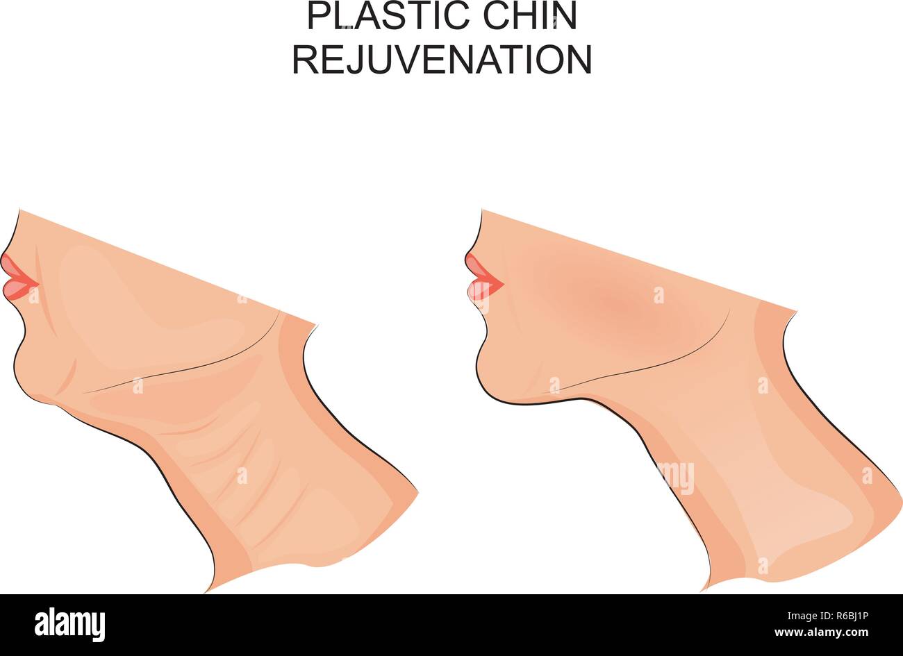 Woman aging before after Stock Vector Images - Alamy