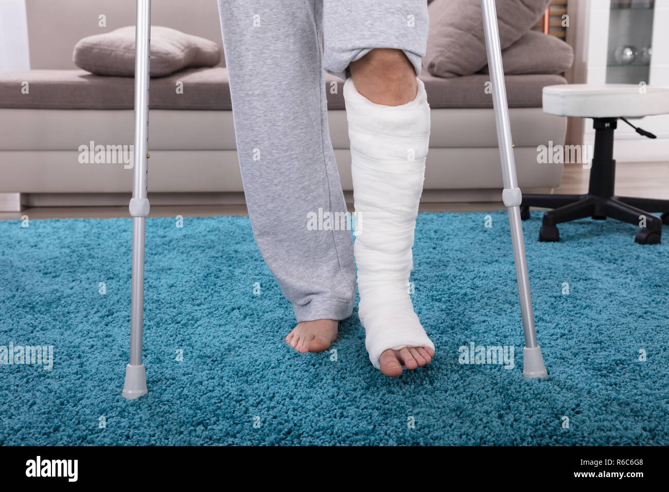 Man With Broken Leg Walking On Carpet Stock Photo - Alamy