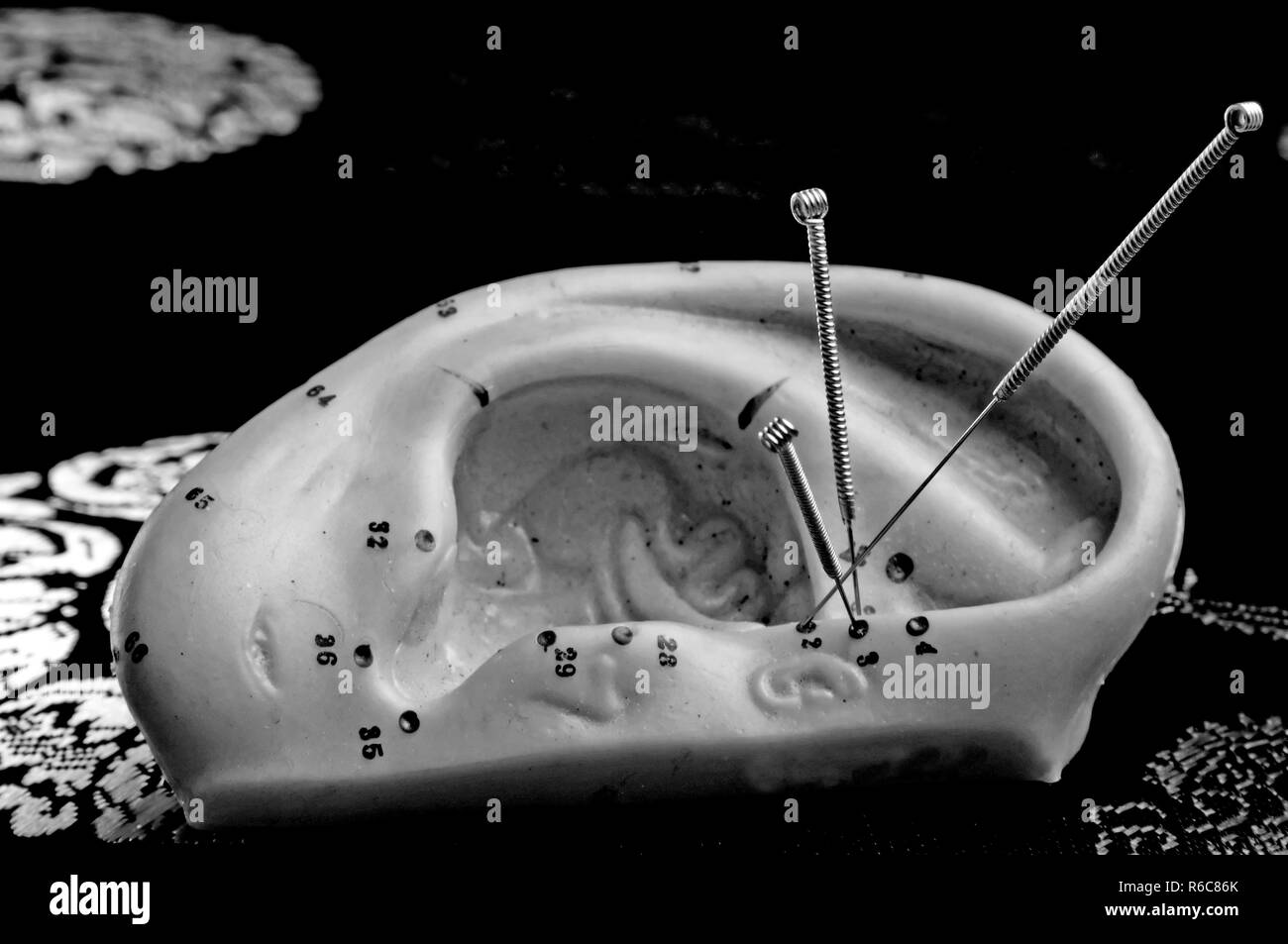 Acupuncture Needles With Ear Model Stock Photo - Alamy
