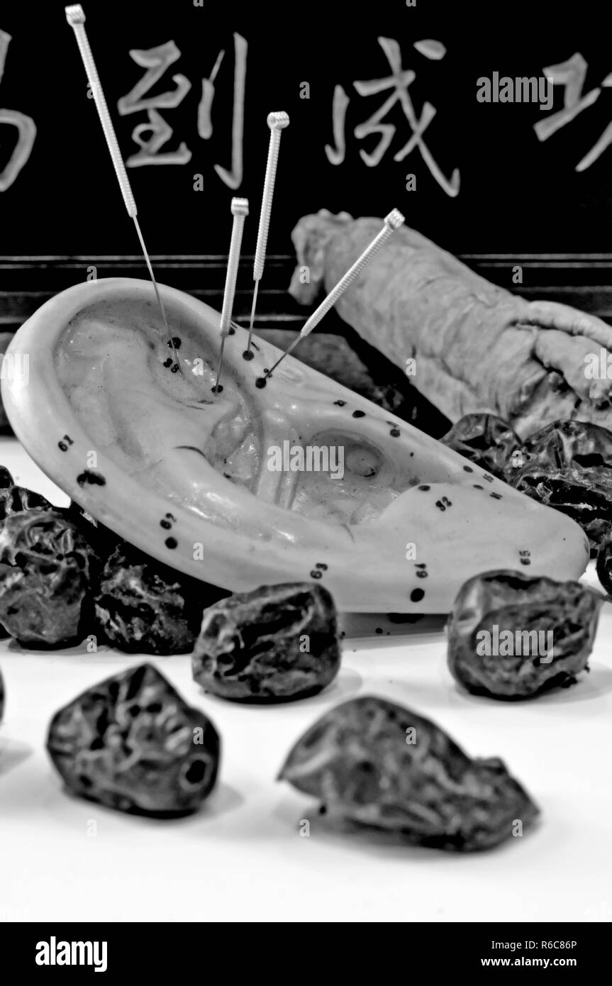 Acupuncture Needles, Ear Model And Chinese Herbs Stock Photo - Alamy