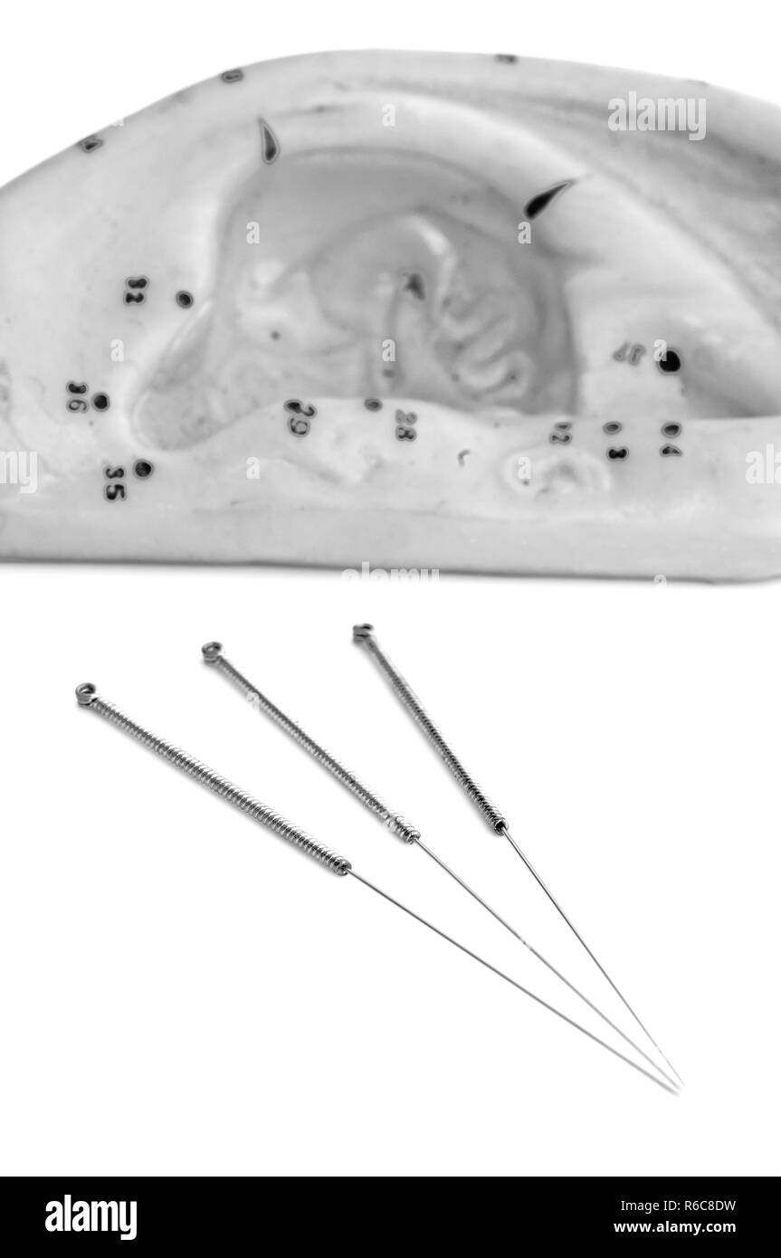 Acupuncture china Black and White Stock Photos & Images - Alamy