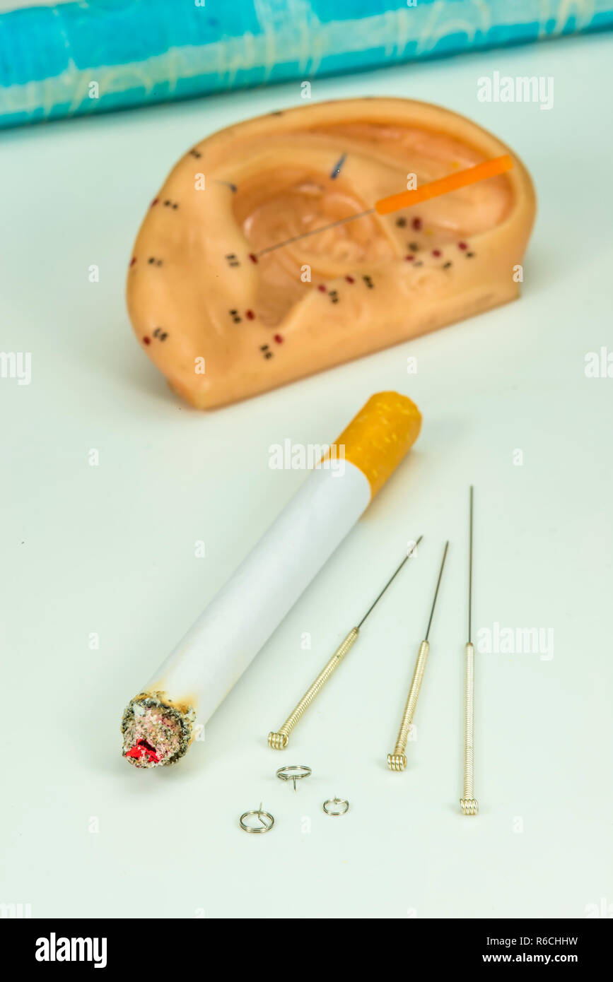 Acupuncture To Stop Smoking Stock Photo - Alamy