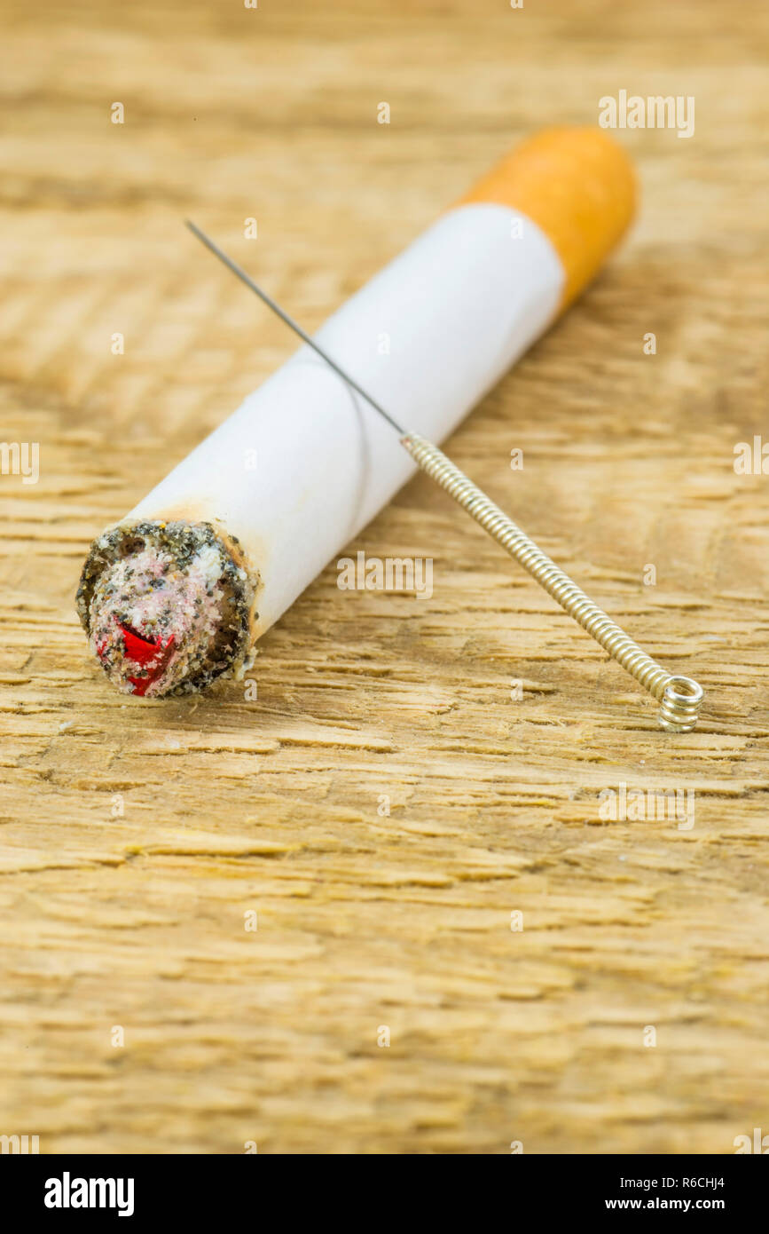 Acupuncture To Stop Smoking Stock Photo - Alamy
