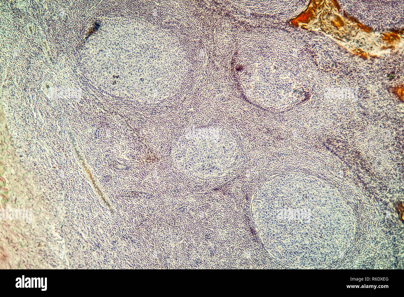 Pharyngeal Tonsil Histology Labeled