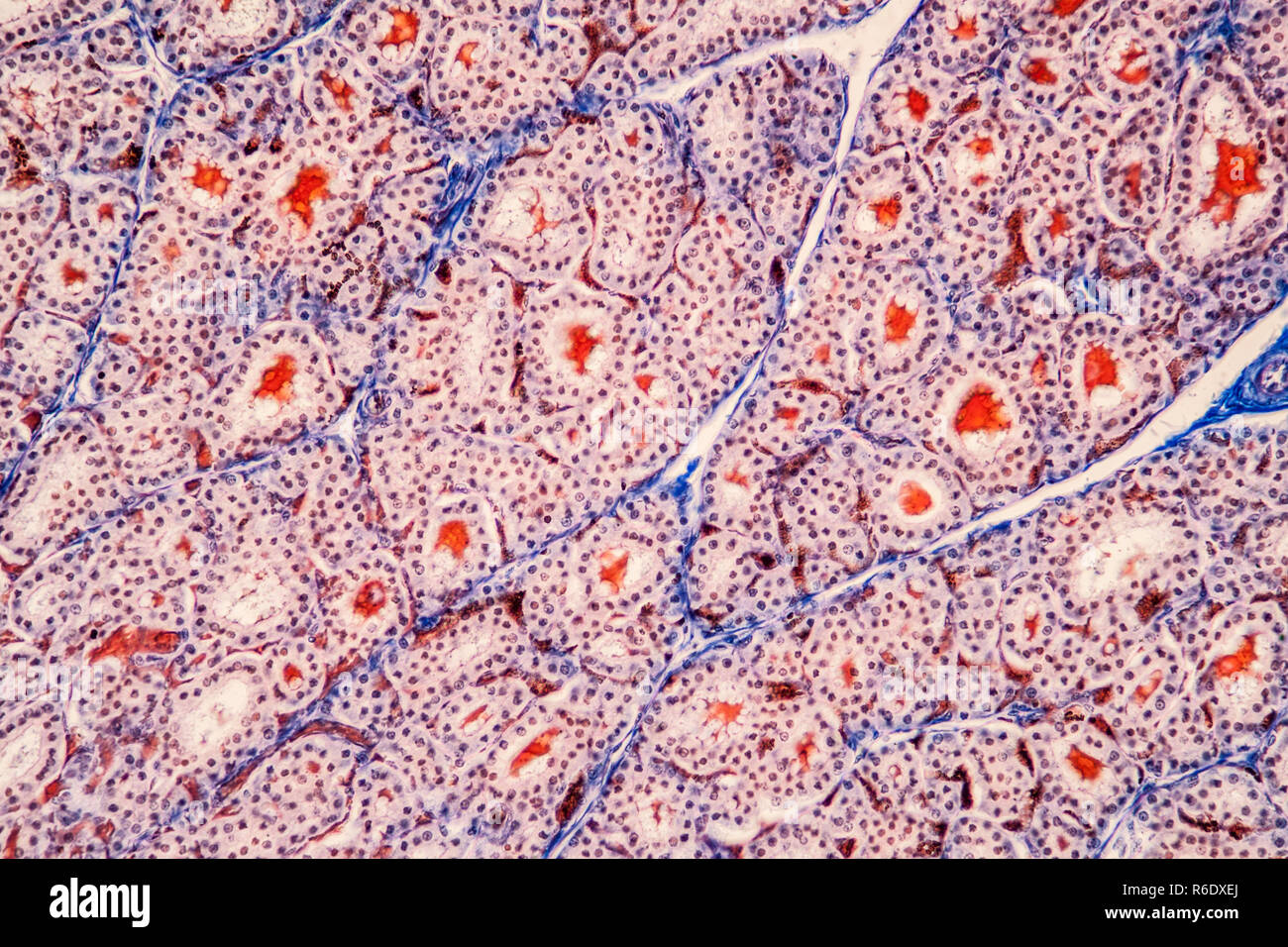 thyroid tissue under the microscope 200x Stock Photo - Alamy