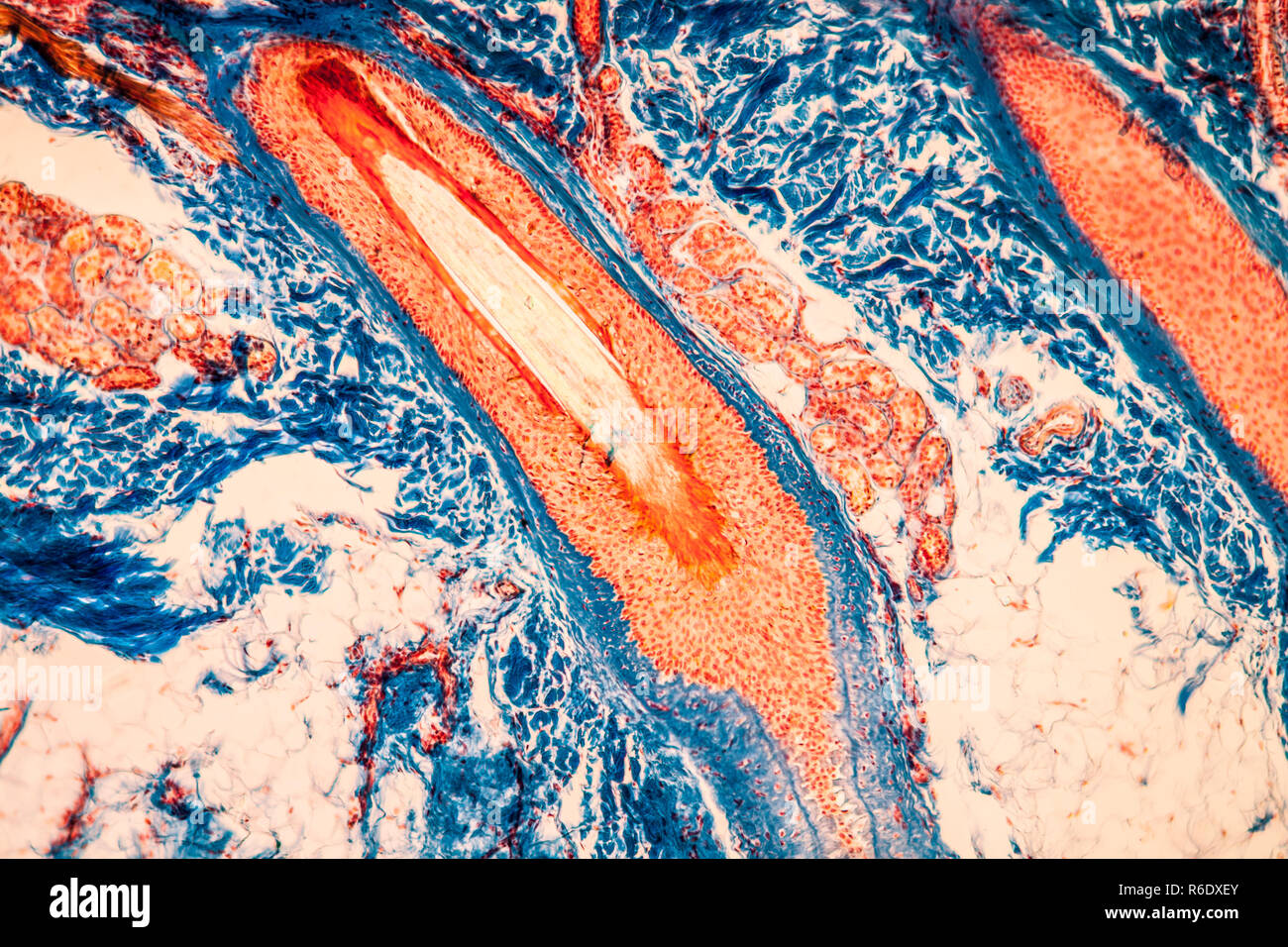 Skin cells microscope hi-res stock photography and images - Alamy