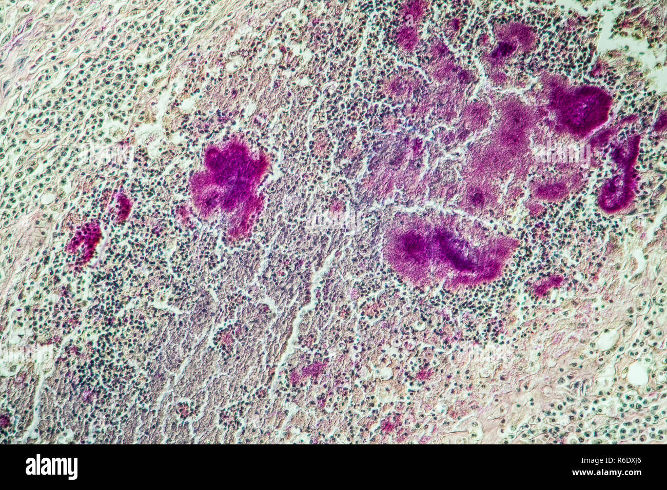 Actinomyces hi-res stock photography and images - Alamy
