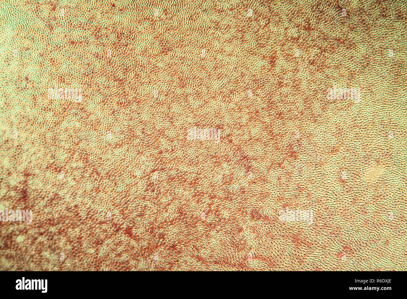 dental crown cross section 100x Stock Photo - Alamy