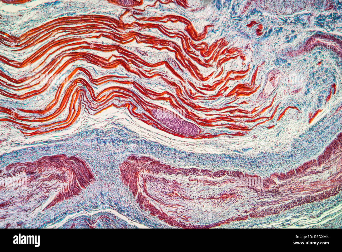 Muscle parasite hi-res stock photography and images - Alamy