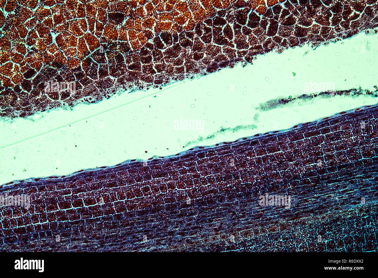 pine embryo with endosperm across 100x Stock Photo - Alamy