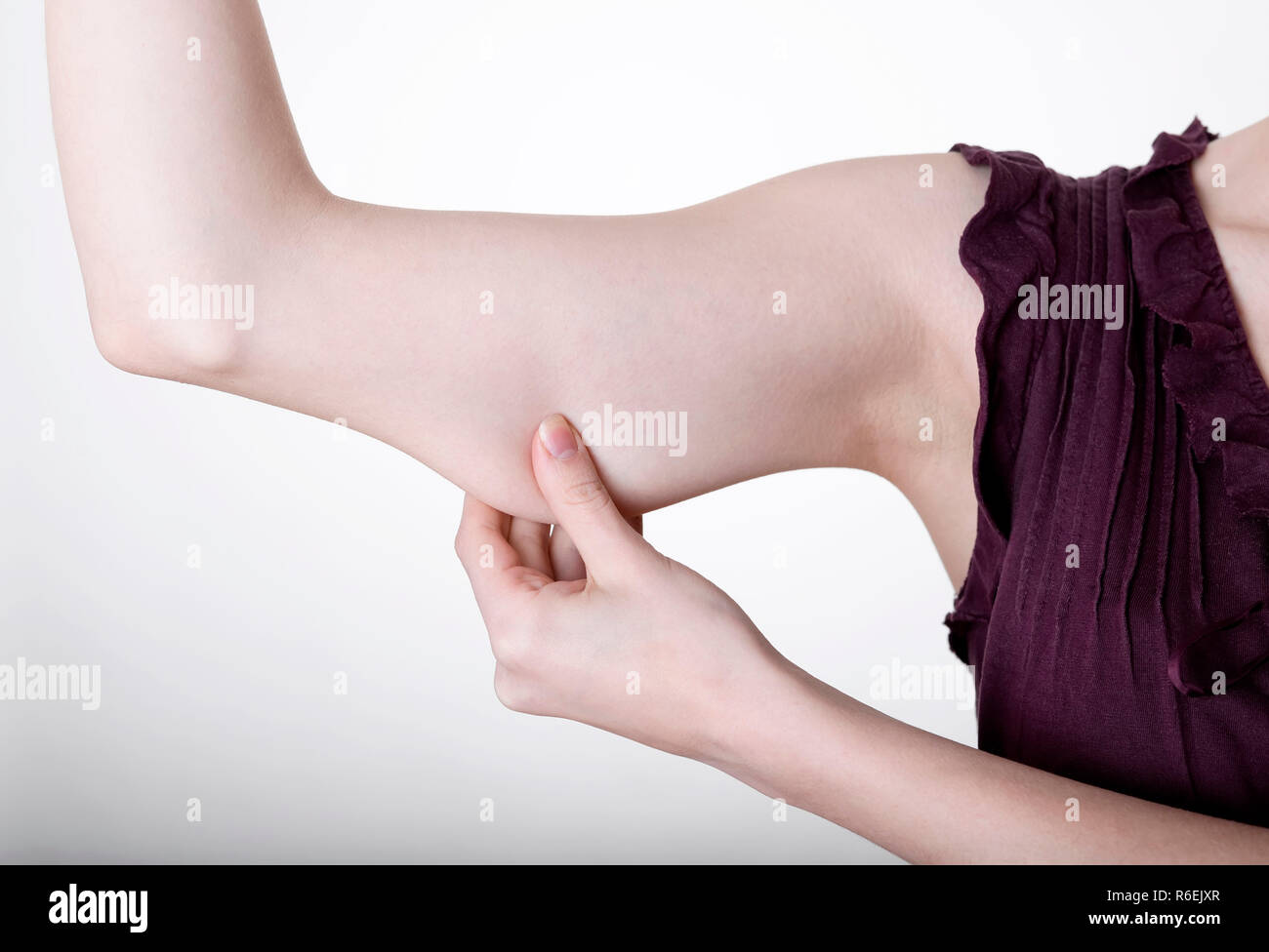 hand pinching in upper arm Stock Photo - Alamy