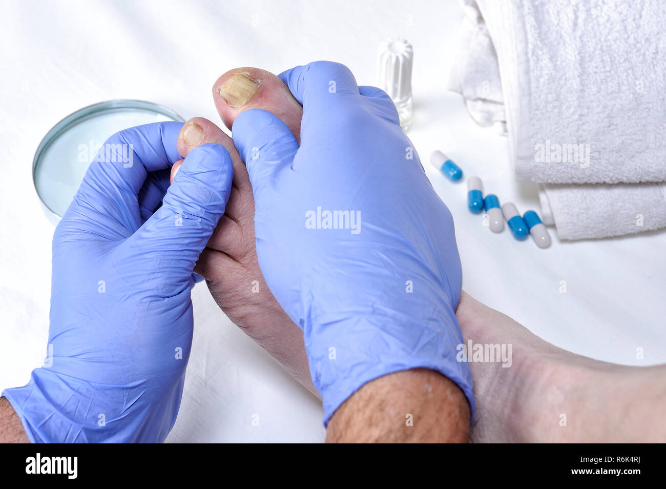 Foot dermatologist hi-res stock photography and images - Alamy