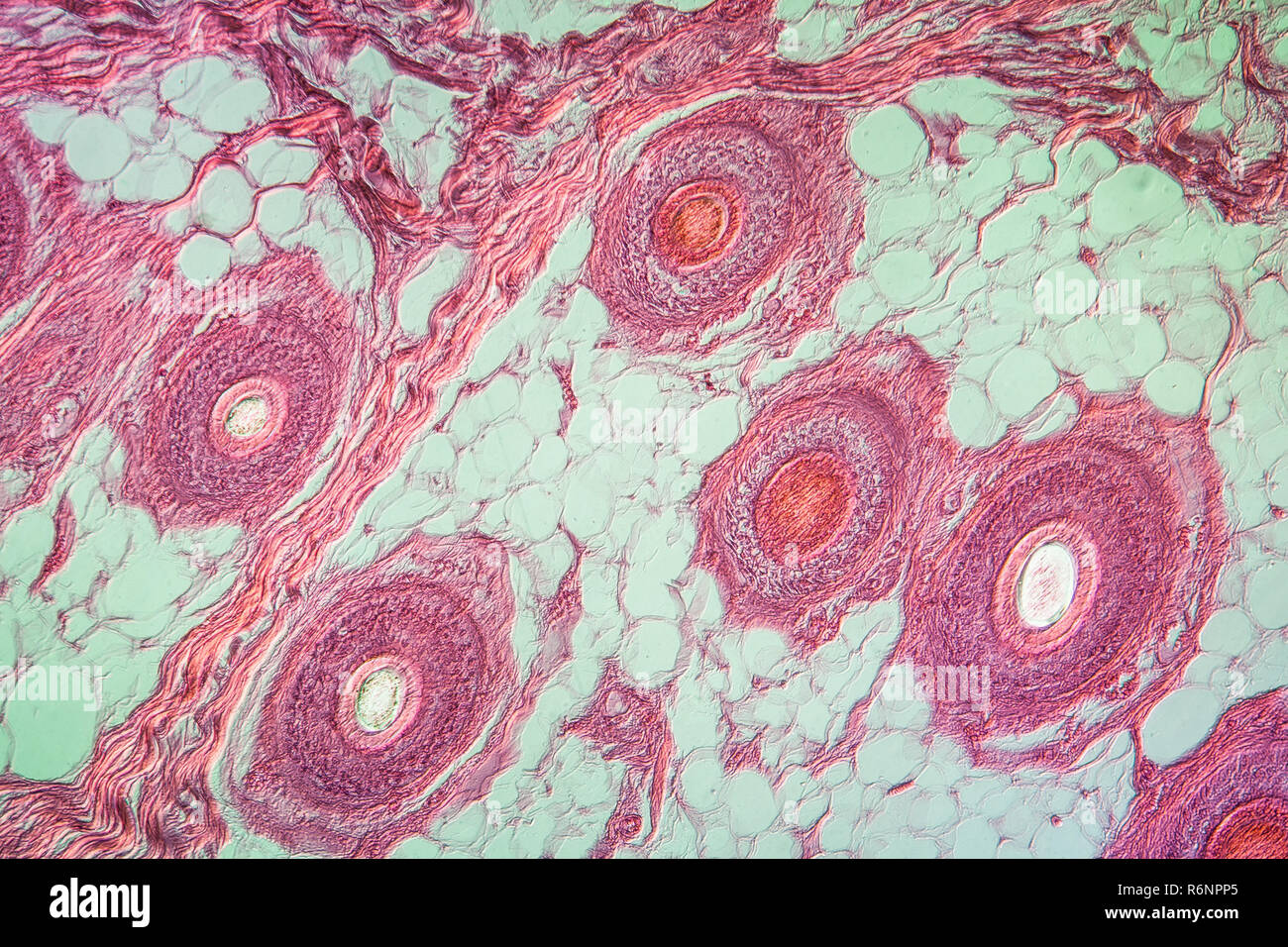 Skin cells microscope hi-res stock photography and images - Alamy