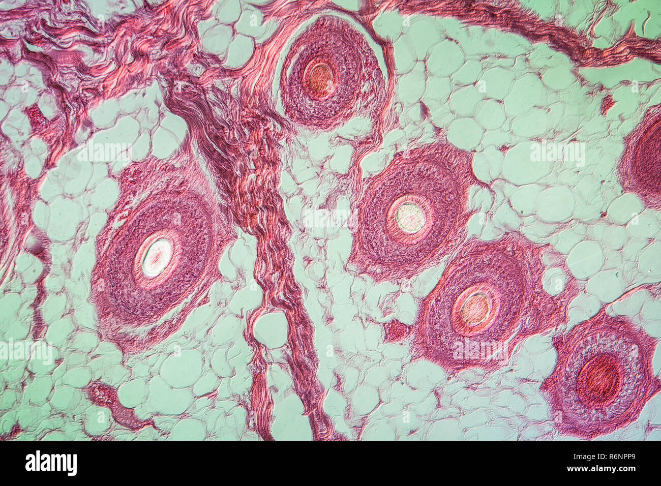 Skin cells microscope hi-res stock photography and images - Alamy