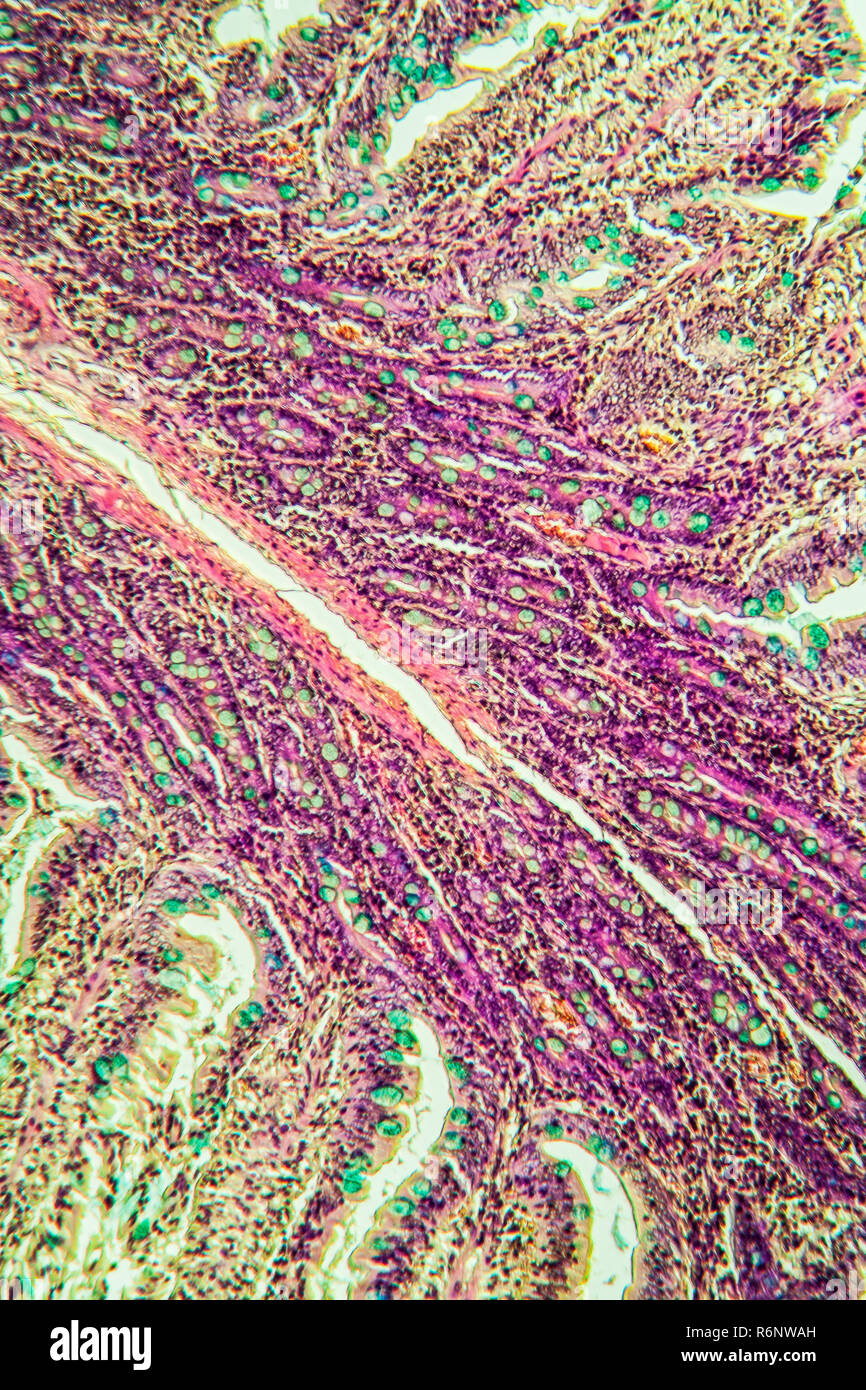 Cross Section Of Small Intestine High Resolution Stock Photography and ...