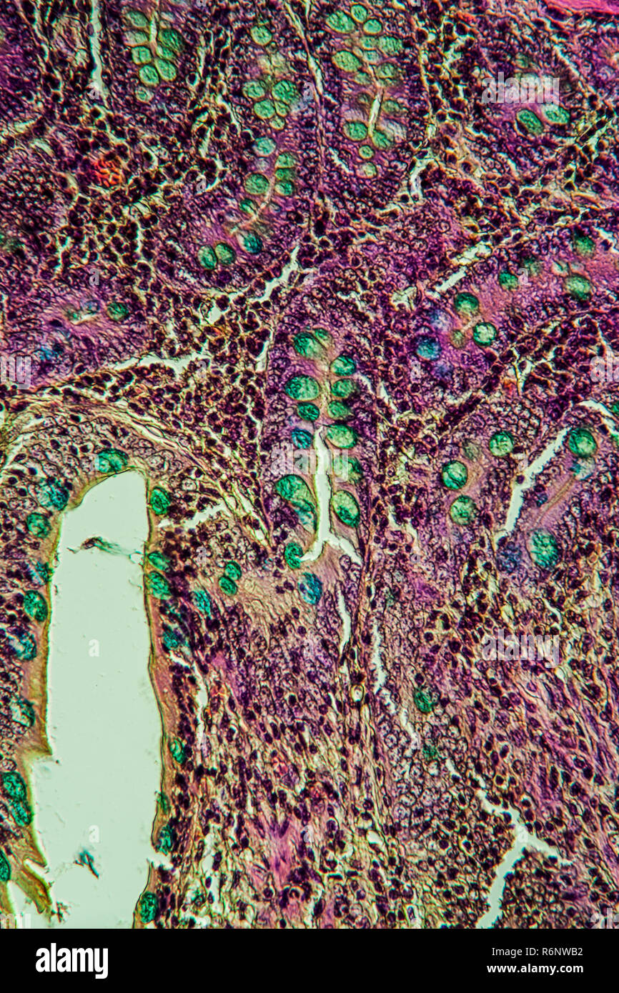 Cross section of small intestine hi-res stock photography and images ...