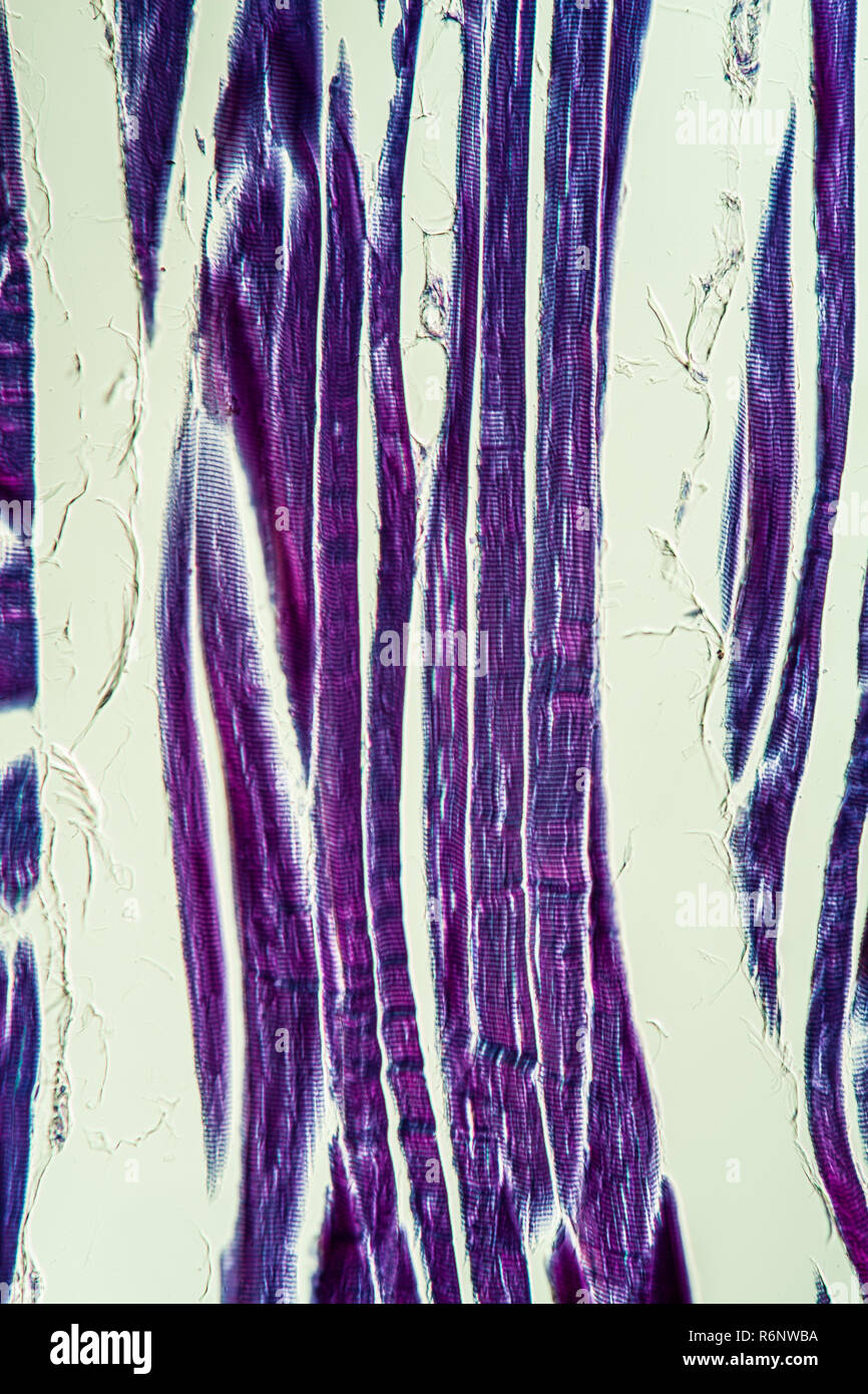Histologie muskel hi-res stock photography and images - Alamy