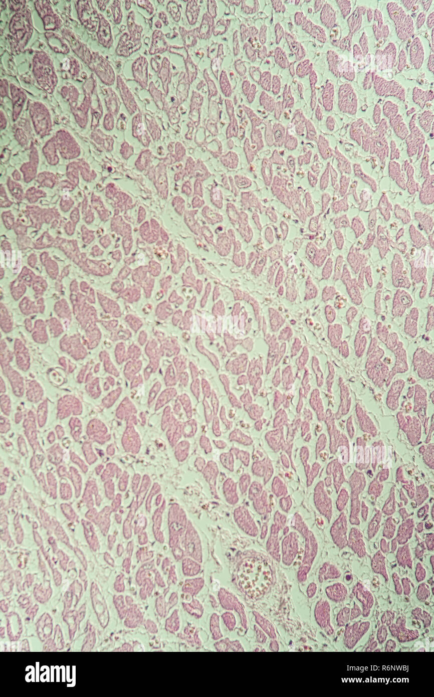 Cardiac tissue microscope hi-res stock photography and images - Alamy