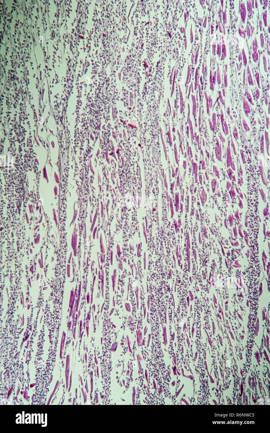 Tissue inflammation microscope hi-res stock photography and images - Alamy