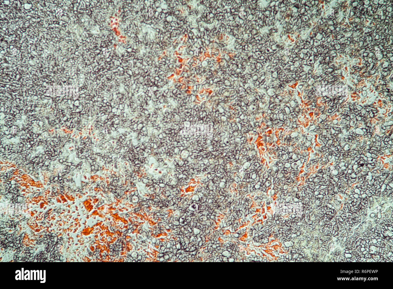 pathogenic fungi in the ear Stock Photo - Alamy