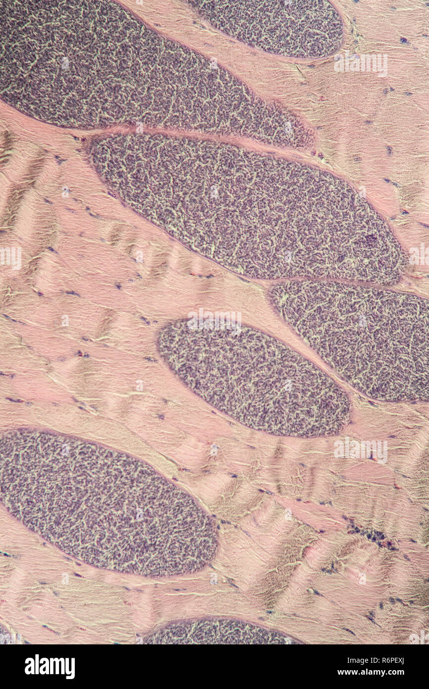 sarcocystis in the monkey Stock Photo - Alamy