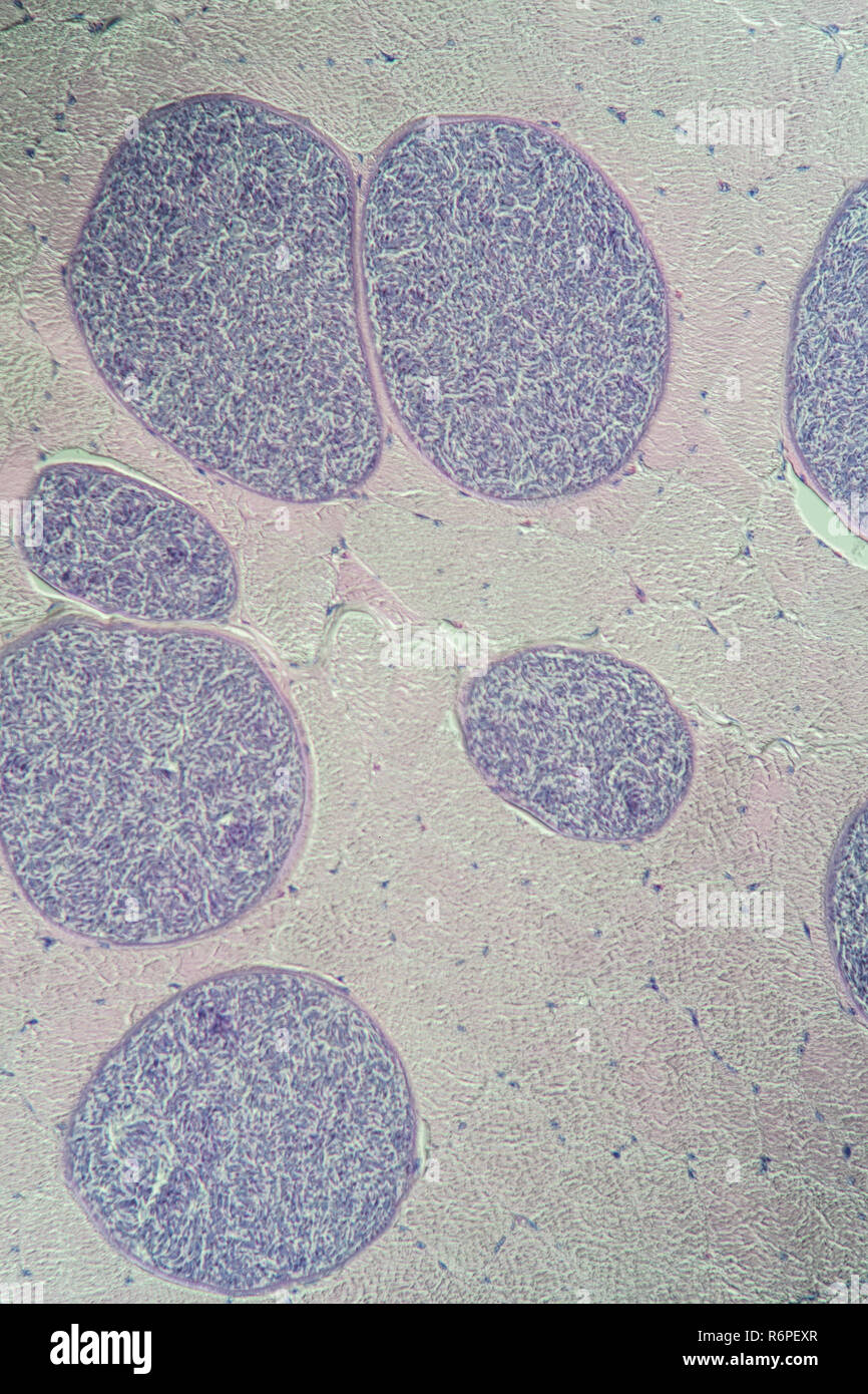 Sarcocystis High Resolution Stock Photography and Images - Alamy