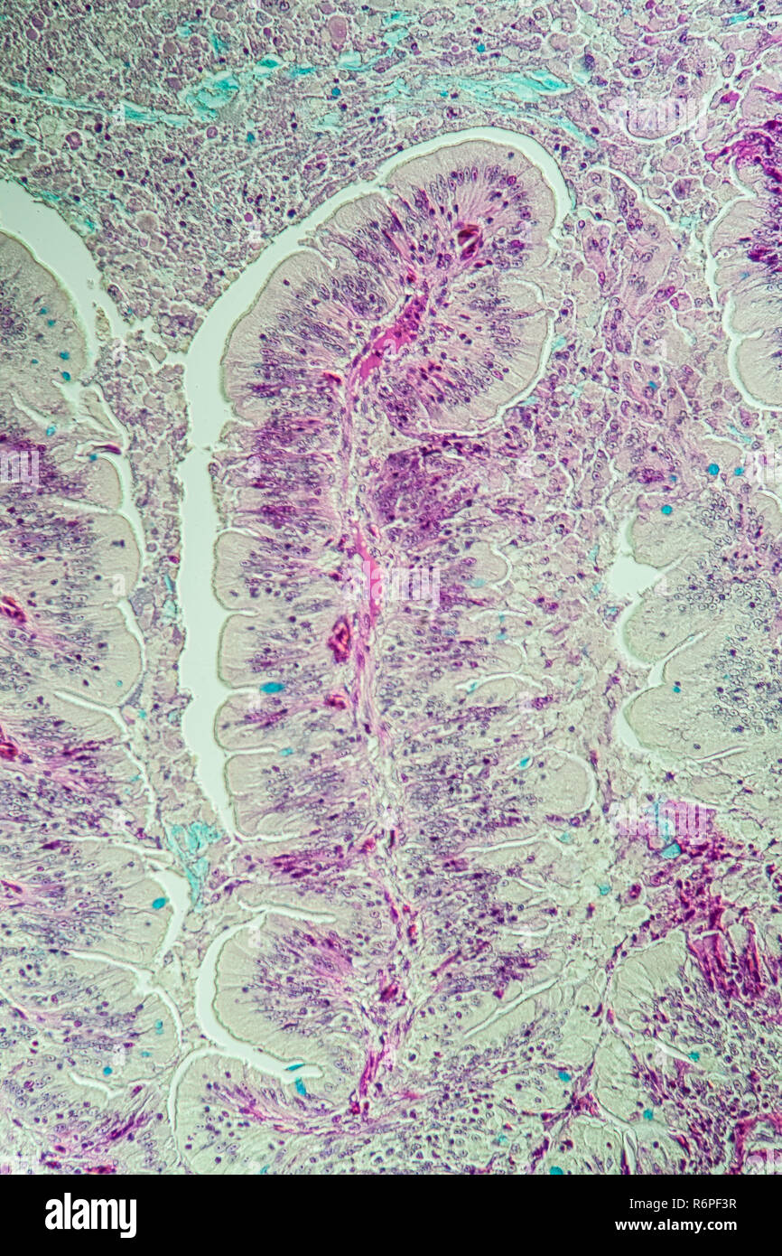 Sekretion hi-res stock photography and images - Alamy