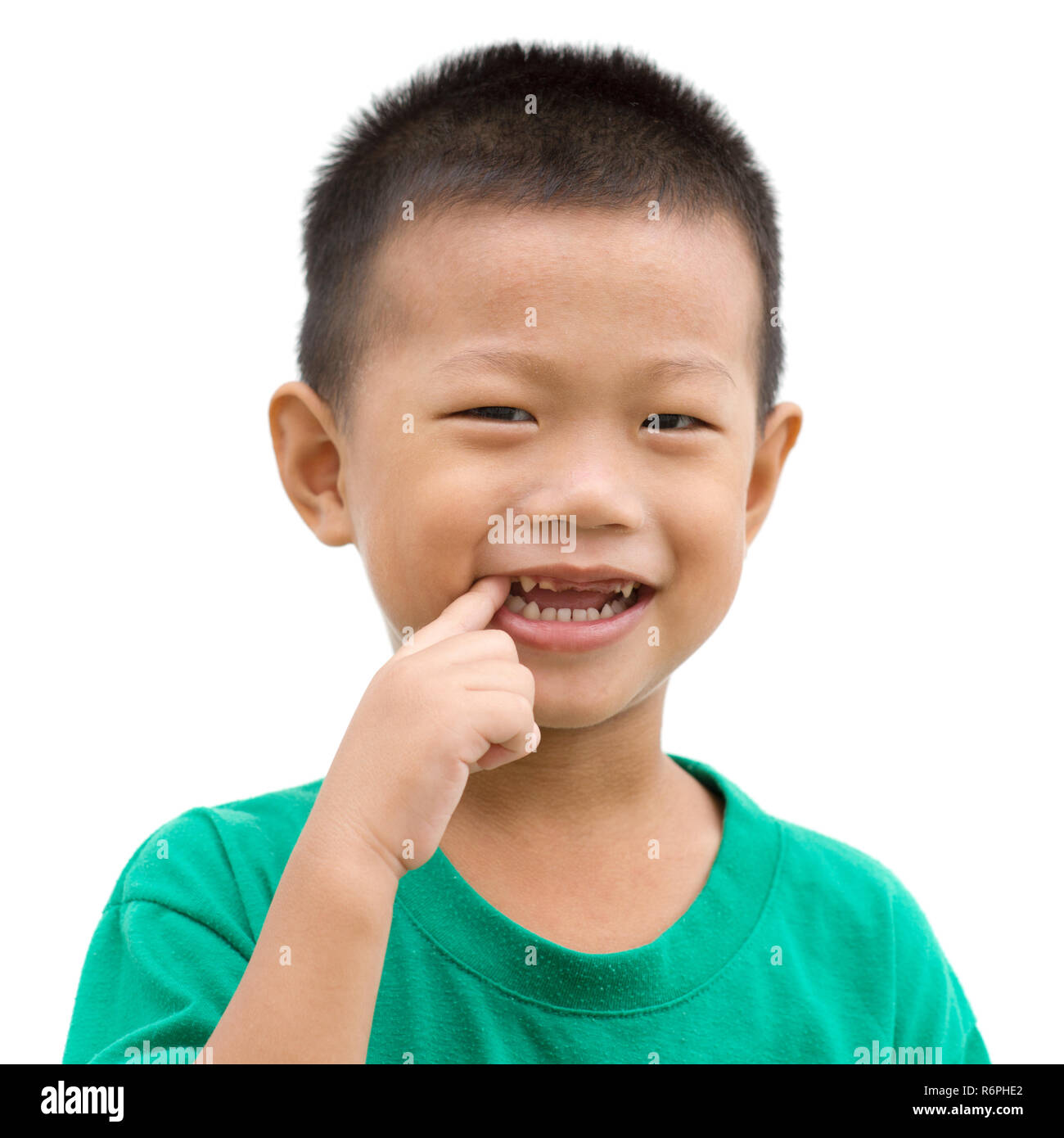 Asian child pointing teeth Stock Photo - Alamy