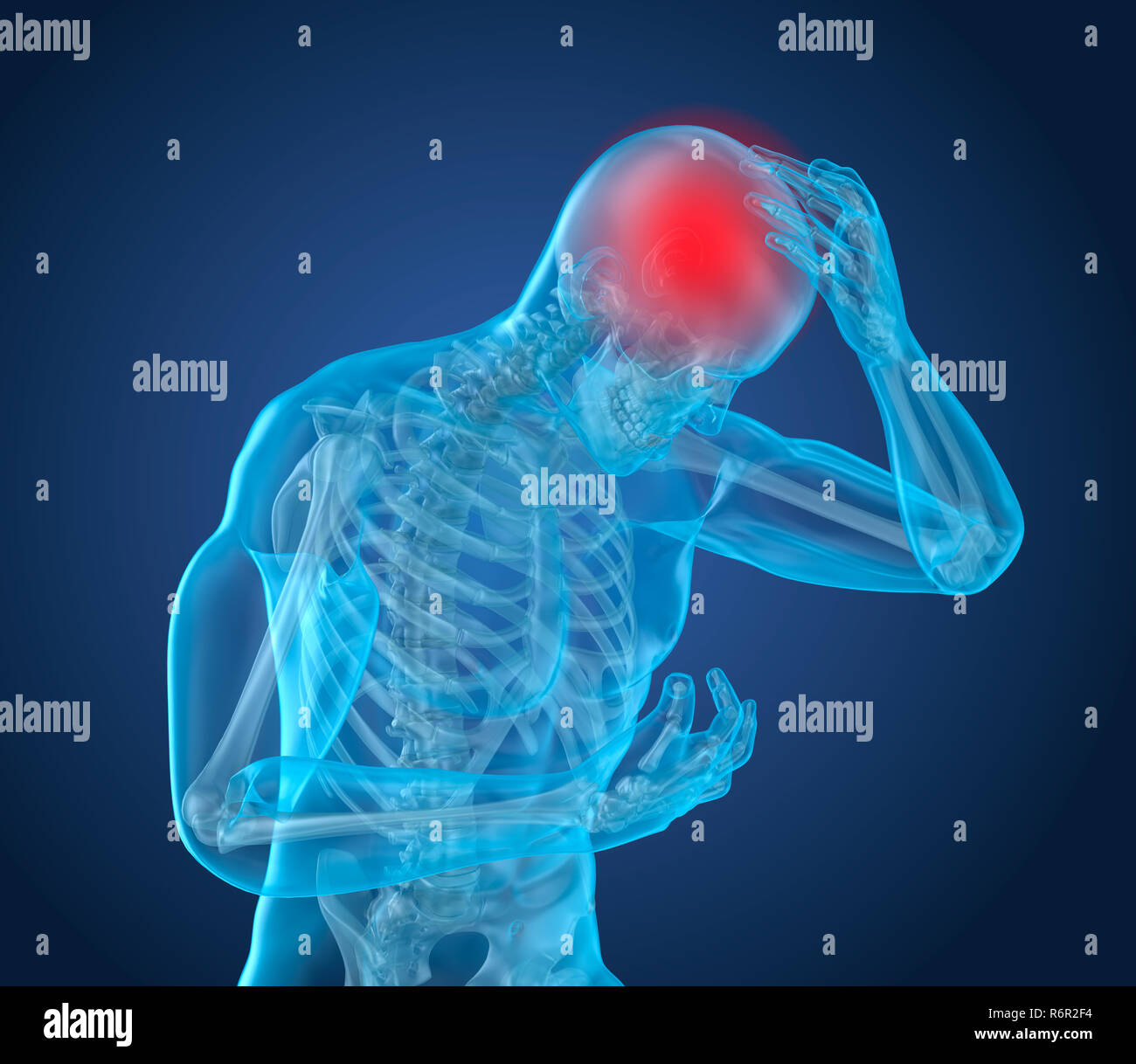 Head pain Attack, man suffering from brain pain. 3D illustration Stock ...