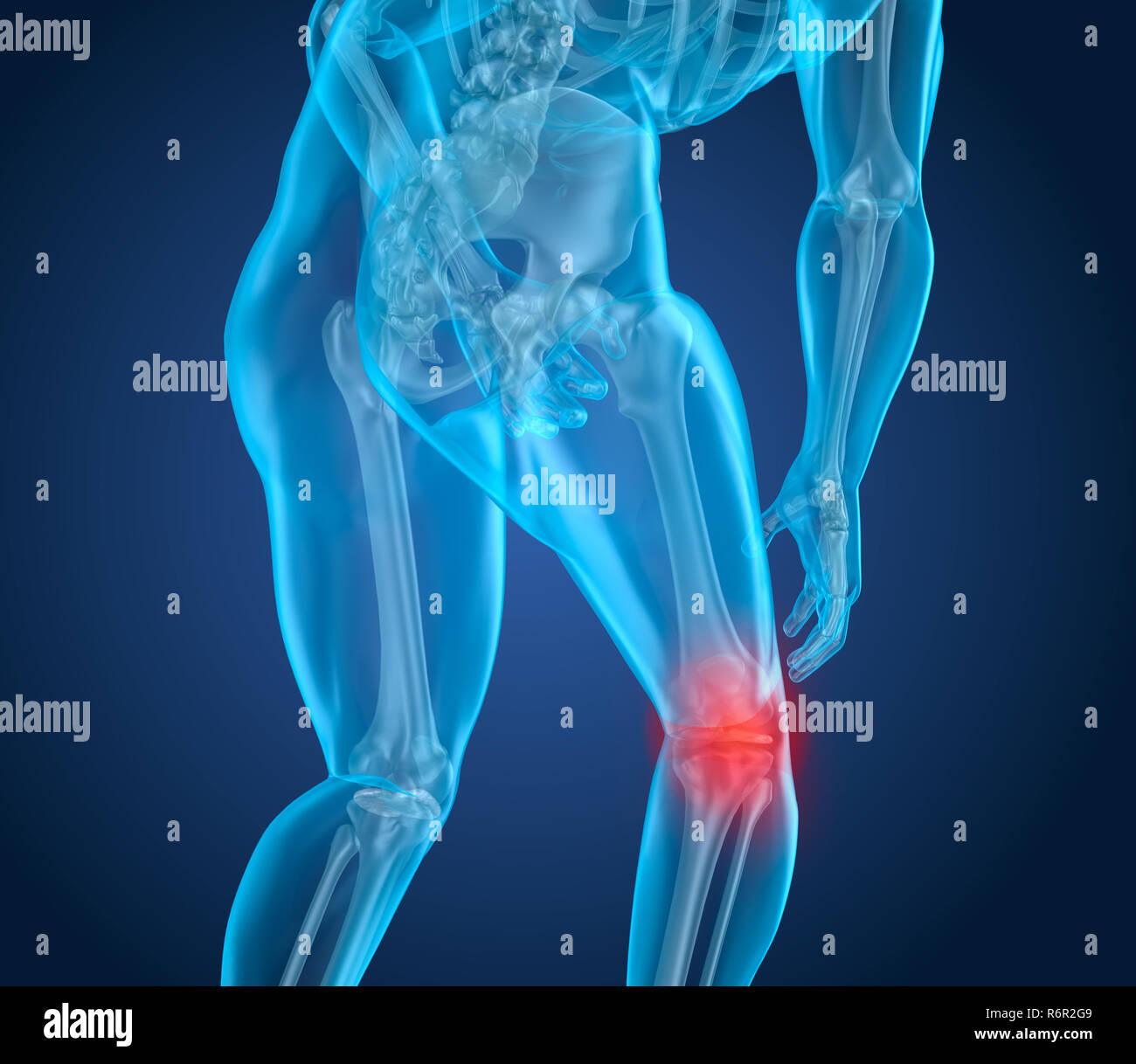 Knee pain Attack, man suffering from spinal knee. 3D illustration Stock ...