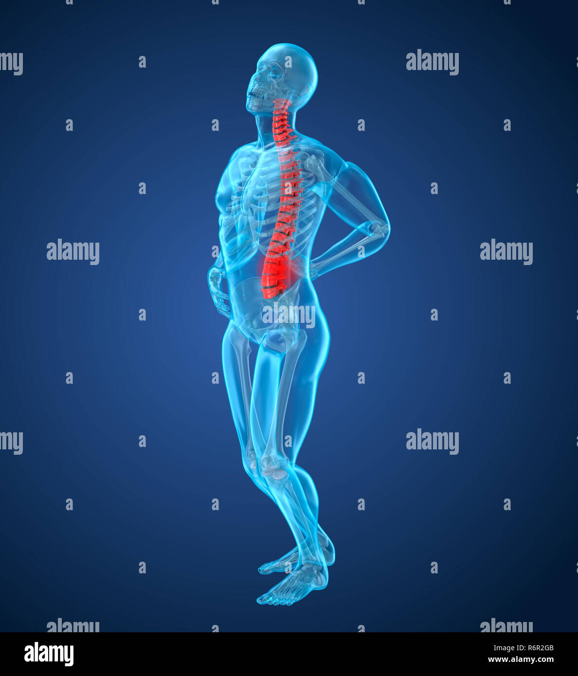 Spinal pain Attack, man suffering from spinal pain. 3D illustration ...