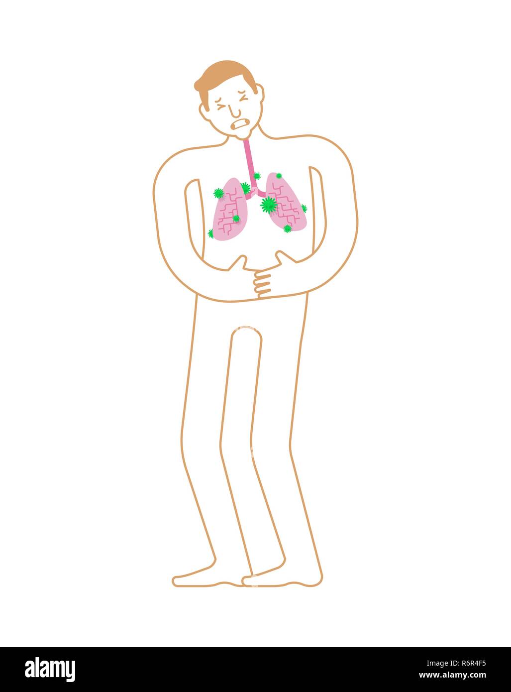 Sick lungs Anatomy of human disease. Diseased internal organ. Aching ...